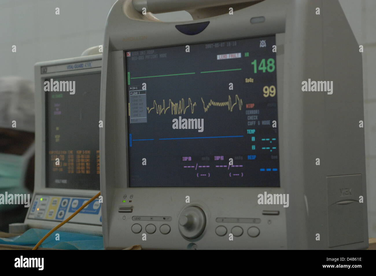 Vital signs monitor during operation Stock Photo - Alamy