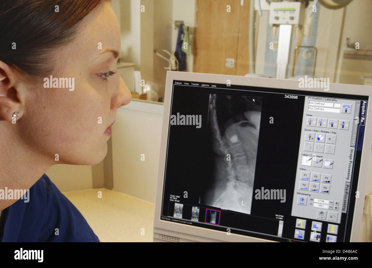 Radiographer analyzing x-ray on computer monitor in x-ray control room ...
