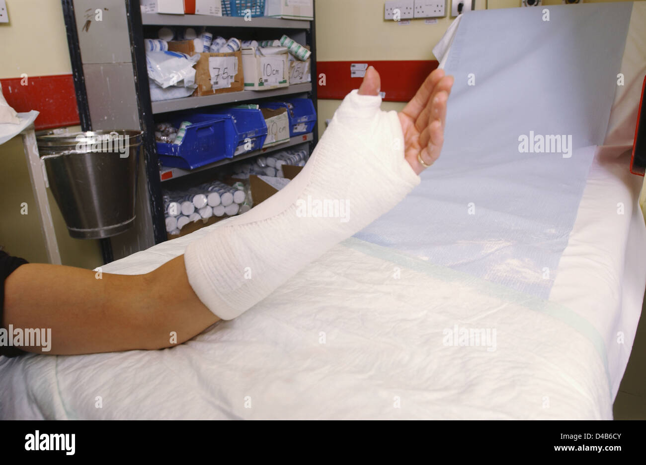 Arm of young woman covered with plaster Stock Photo - Alamy