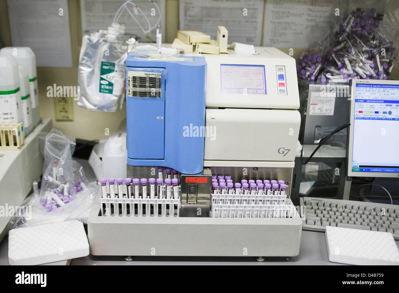 Blood samples processed through automated blood analysis machine Stock ...