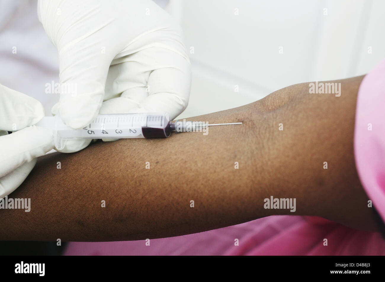 Nurse inserting needle to draw blood from patients arm Stock Photo - Alamy