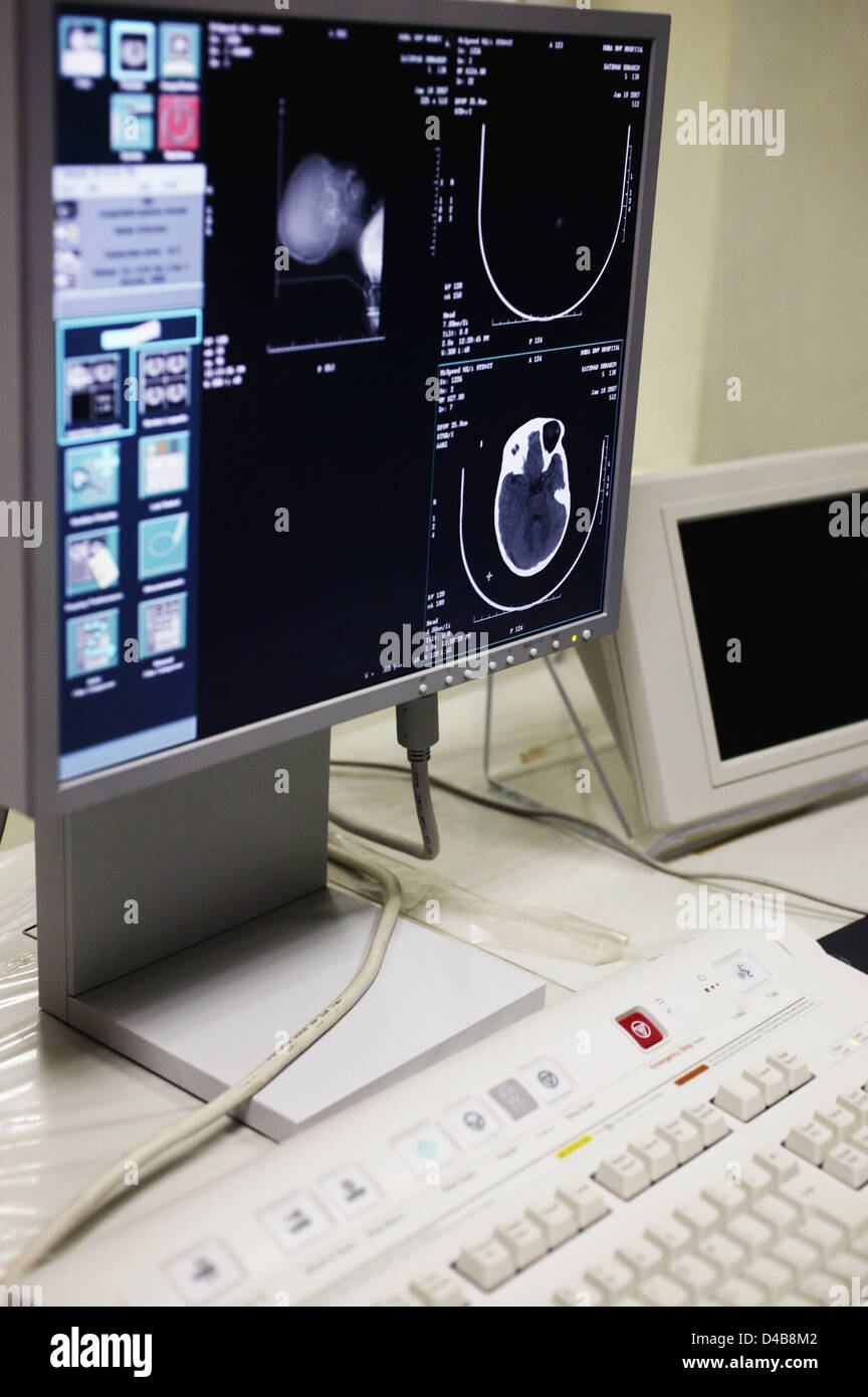 Control panel and control screen of a Computed Tomography (CT) scan ...