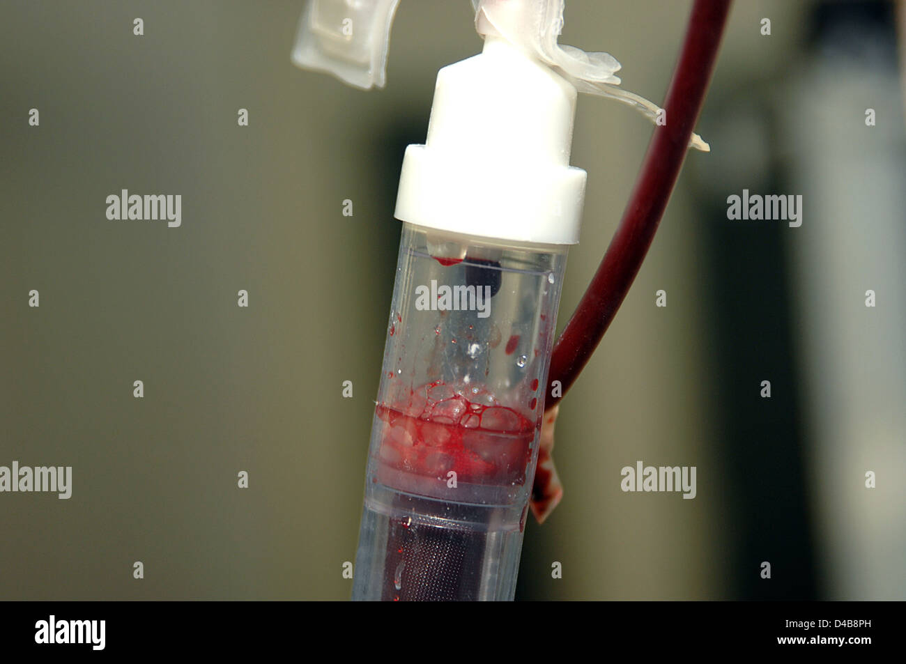 Intravenous drip, leading from blood bag. Sudan, Africa Stock Photo - Alamy