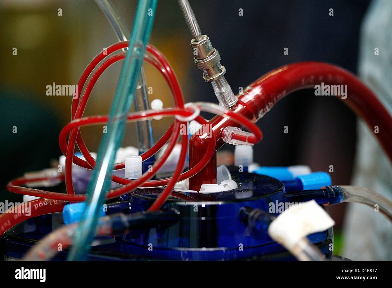 Heart lung machine hi-res stock photography and images - Alamy