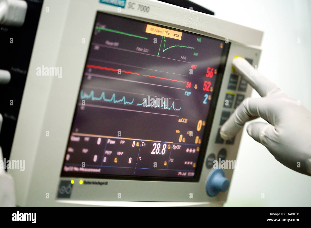 The ECG used during operations works in conjunction anesthetic machine ...