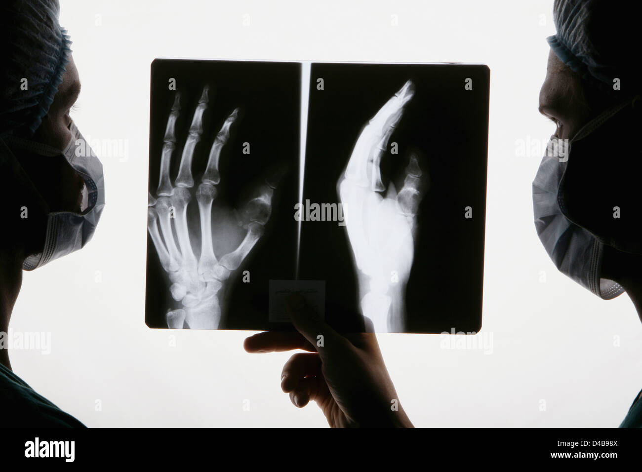 Two surgeons examining x-ray of hand before surgery Stock Photo - Alamy