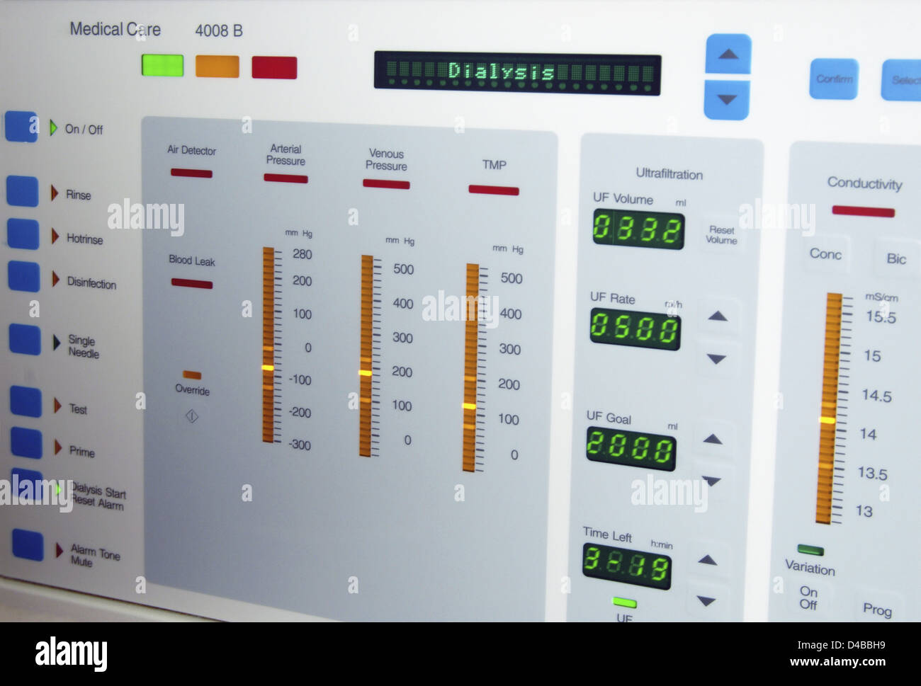 Typical Control Display For Hemodialysis Machine High Resolution Stock ...