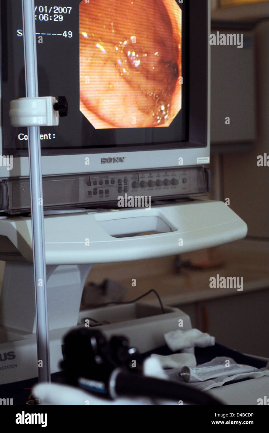 The video camera on tip endoscope sends picturse directly back screen ...