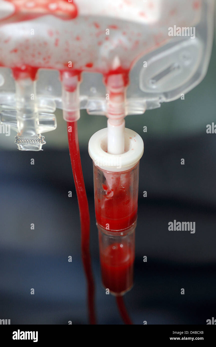 Any complex surgery can not be performed without need blood transfusion ...