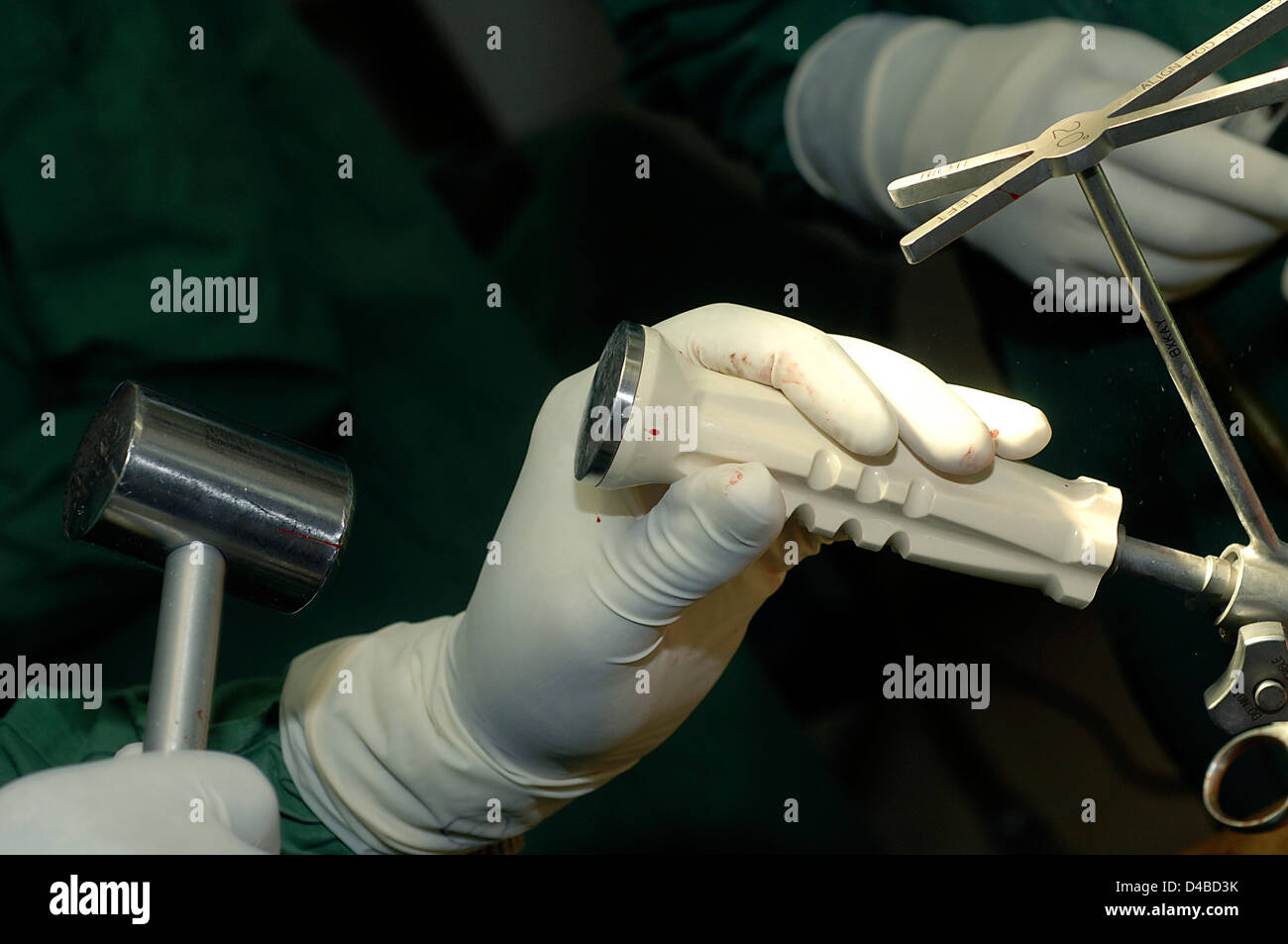 Hip Replacement Surgeon taps acetabular shell into position using ...