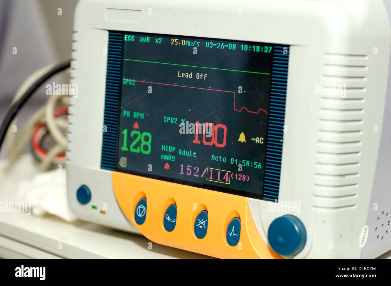 Machine is used to monitor patient's vital signs throughout surgery ...