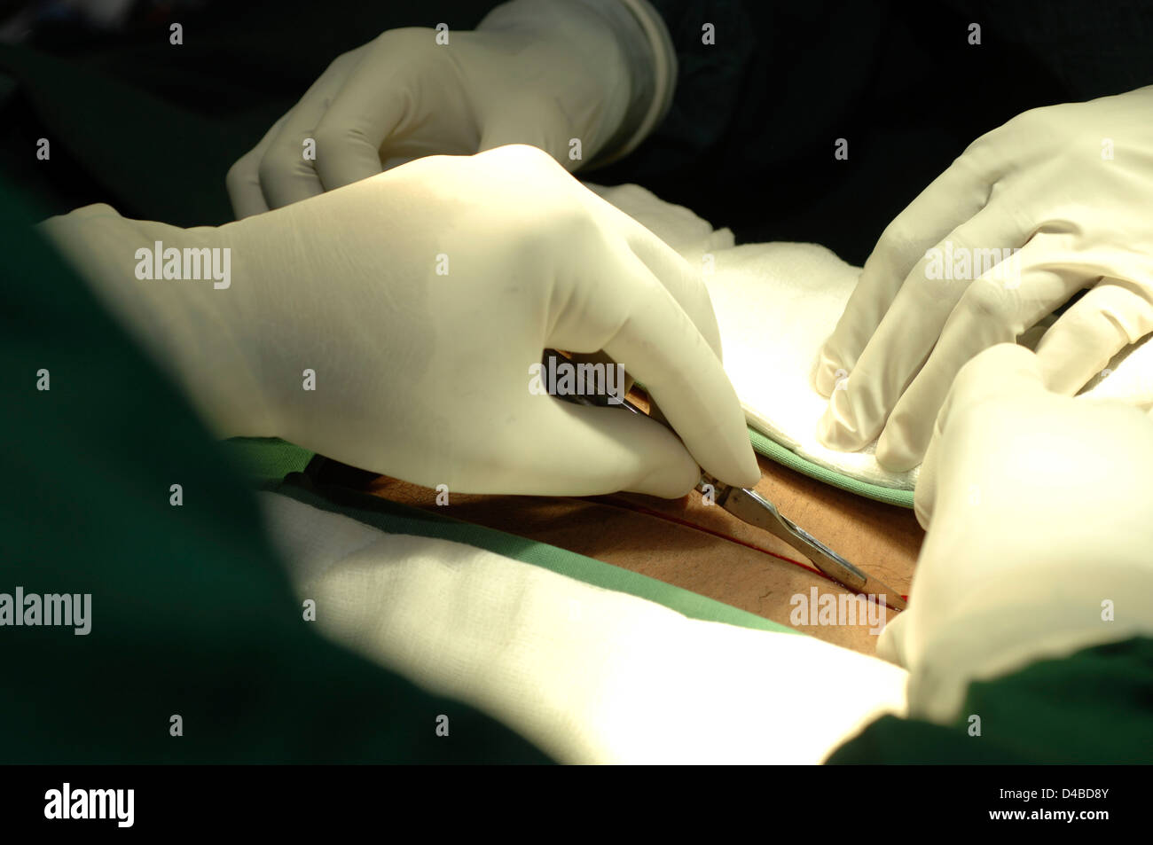 Skin incision hi-res stock photography and images - Alamy