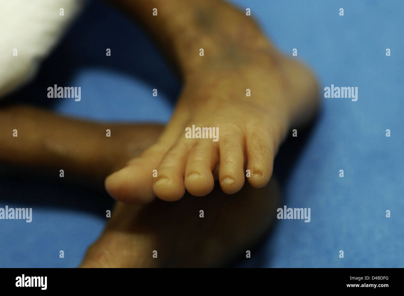 Premature babies are placed in incubator as they have not fully ...