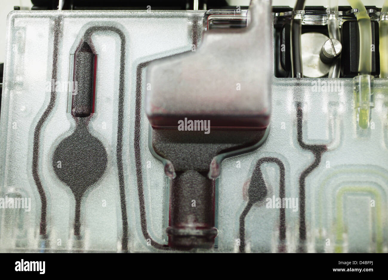 Trima Accel automated blood collection system helps optimize blood ...