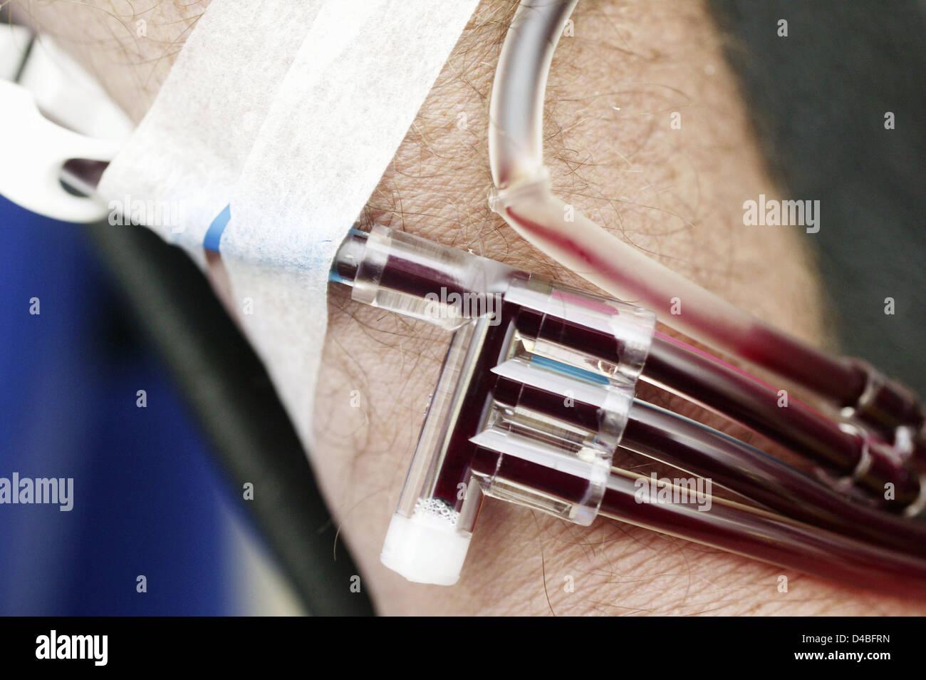 Tubes around blood donors arm collecting blood Stock Photo - Alamy