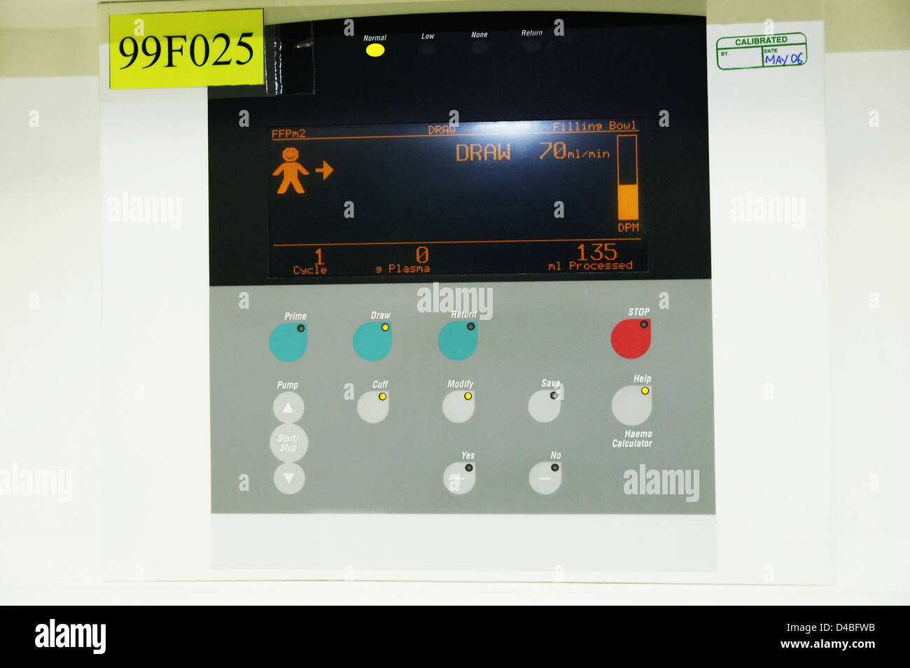 Haemonetics mcs blood collection separation system hi-res stock ...