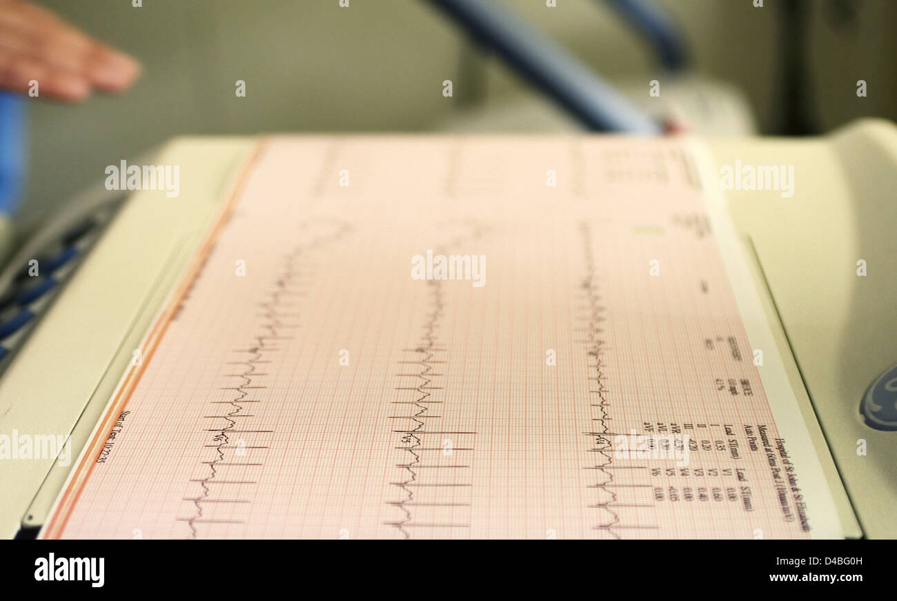Electrocardiogram recording of patients cardiac cycle produced by ...