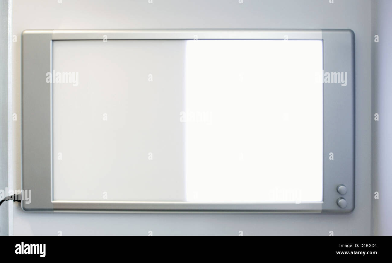 Doctors wall mounted screen review patients scan hi-res stock ...