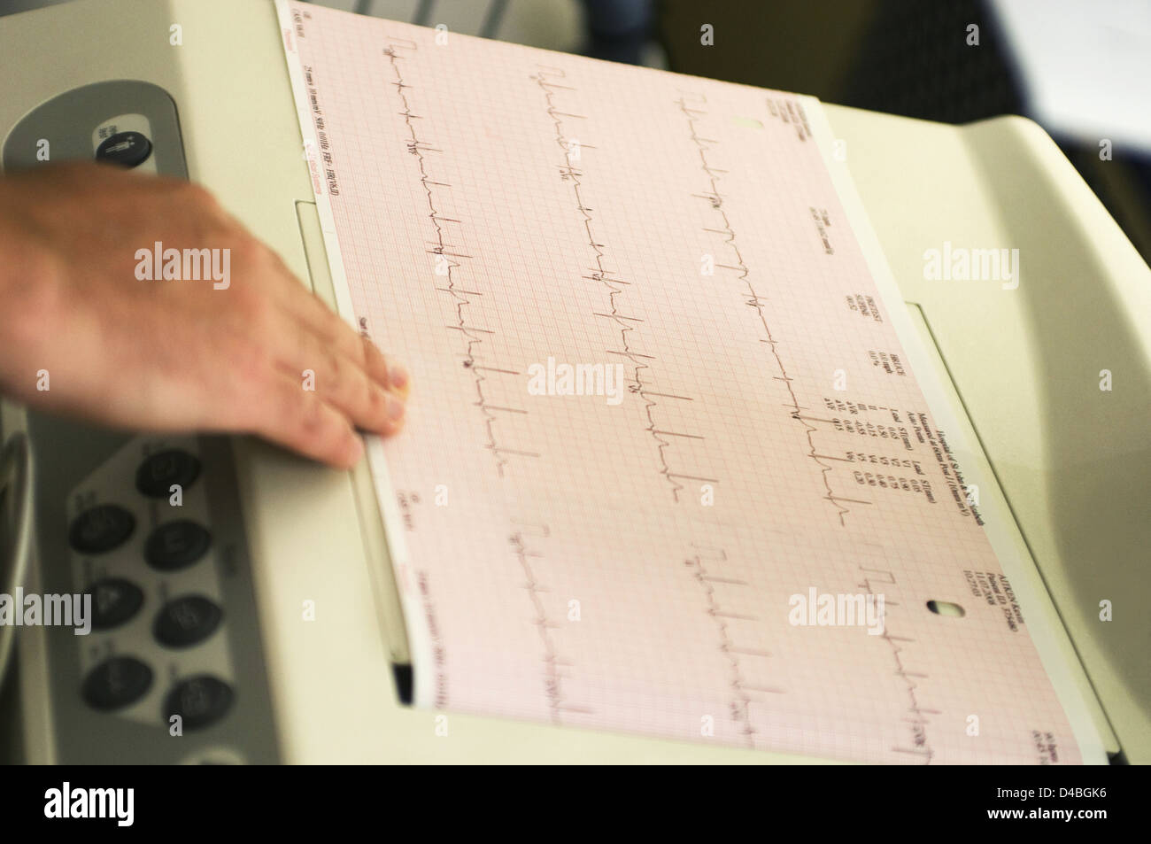 Electrocardiogram recording of patients cardiac cycle produced by ...