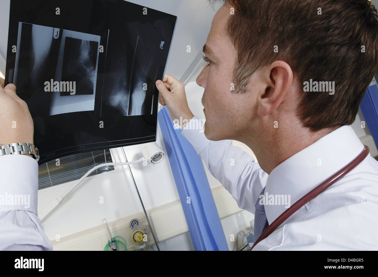 Doctor examining patients x-ray Stock Photo - Alamy