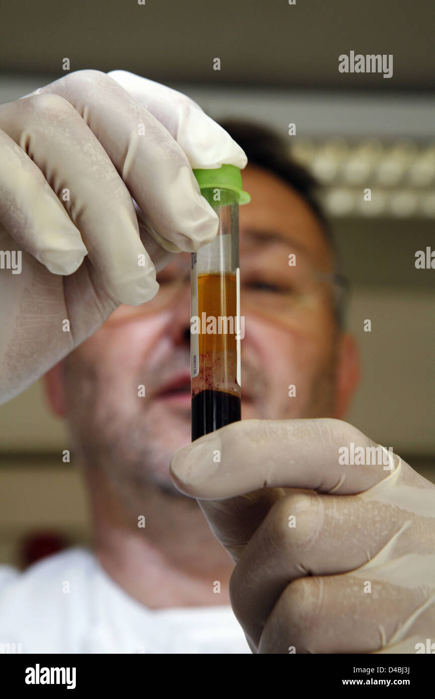 Pathologist analyzing blood sample contained in phial Stock Photo - Alamy