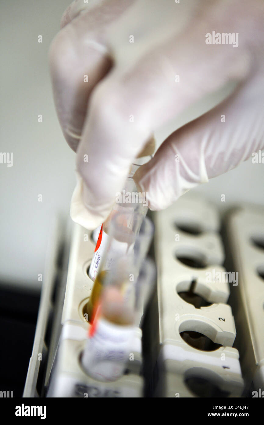 Pathology specimen hi-res stock photography and images - Alamy
