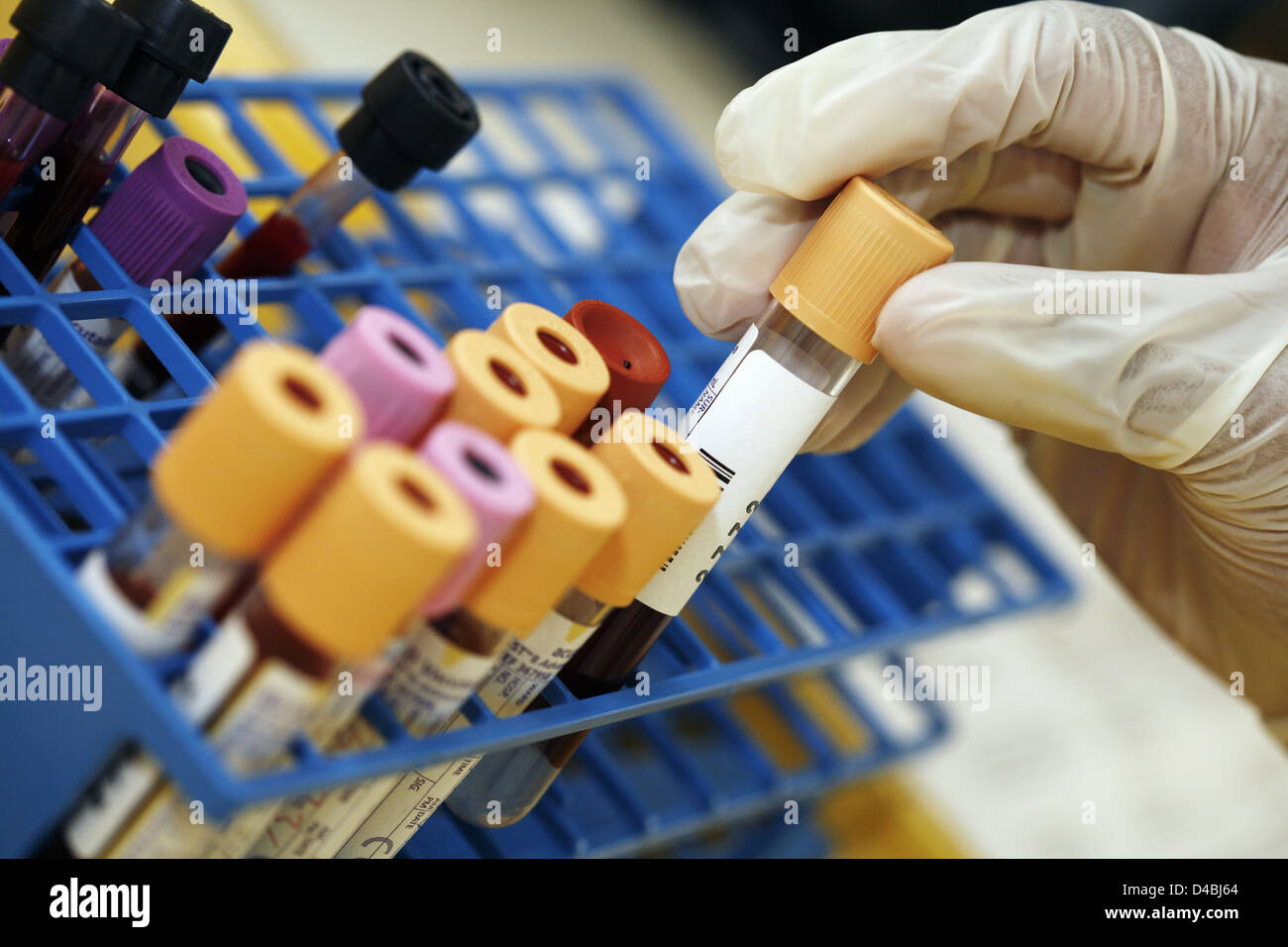 Pathologist placing blood filled phials into holding rack Stock Photo ...
