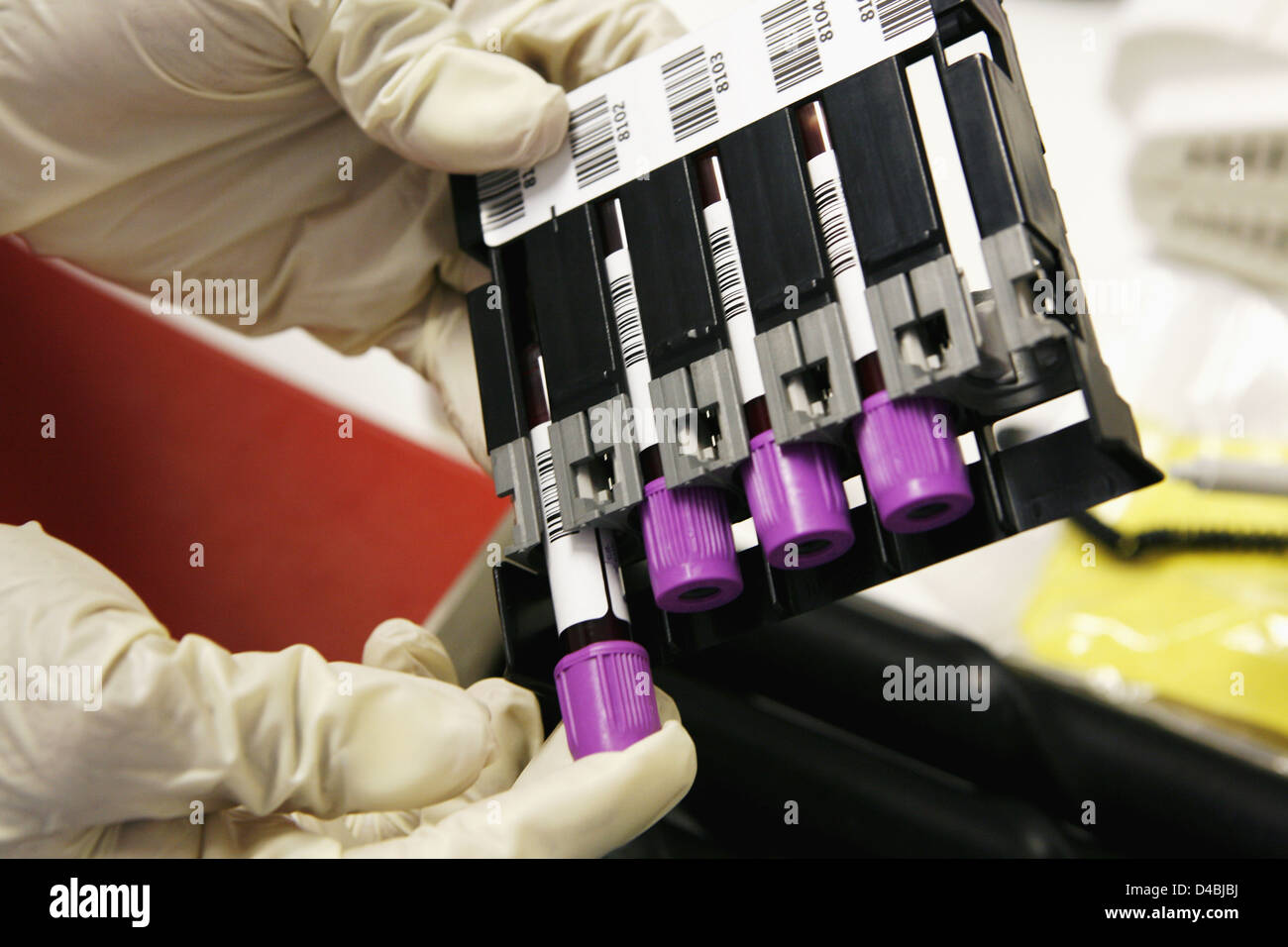 Laboratory technician removing bar coded blood specimens from test tube ...
