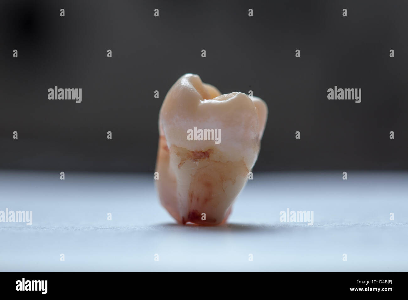 A clean extracted wisdom tooth, not fully developed Stock Photo - Alamy