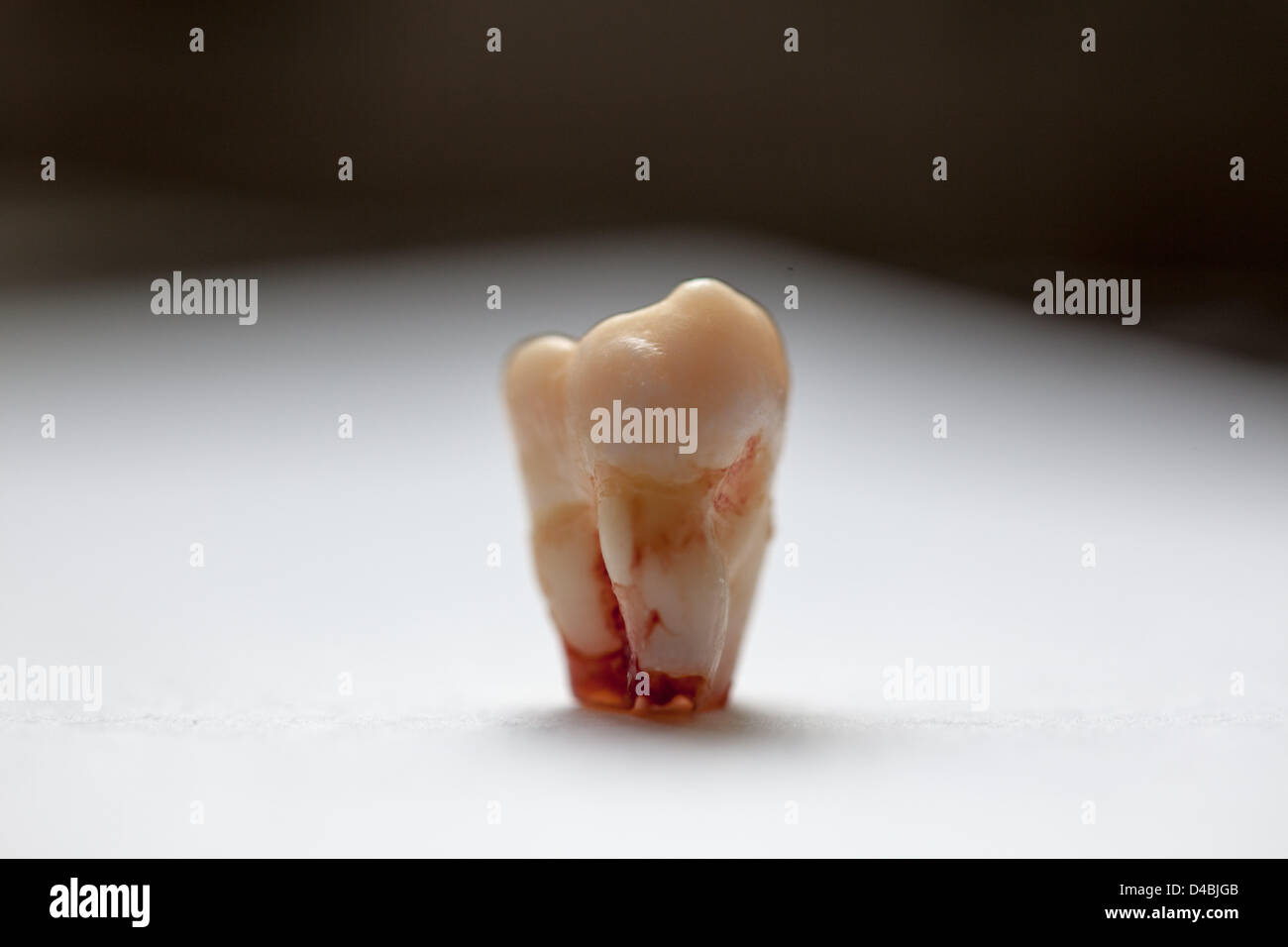 A clean extracted wisdom tooth, not fully developed Stock Photo - Alamy