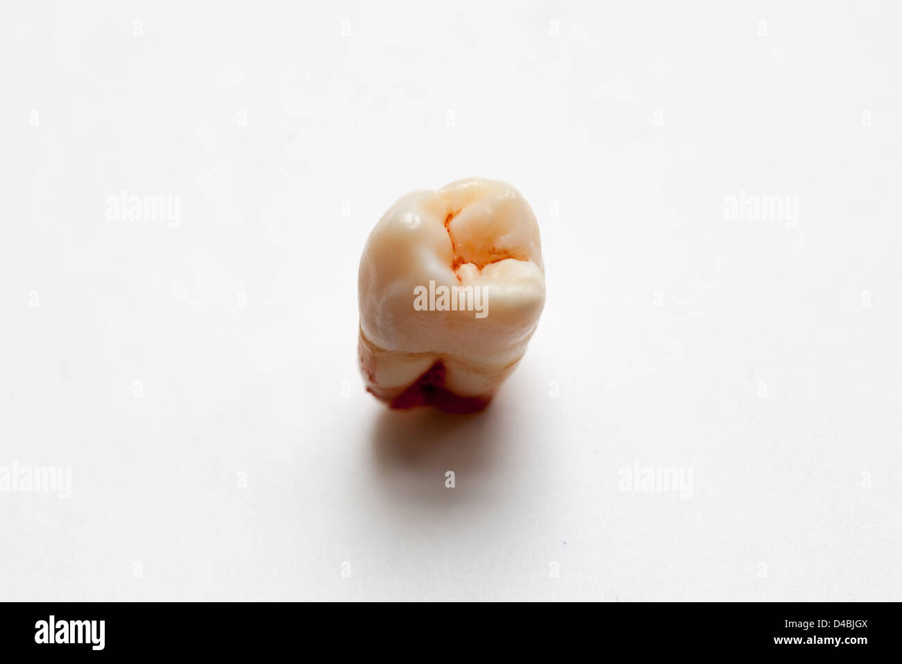 A clean extracted wisdom tooth, not fully developed Stock Photo - Alamy