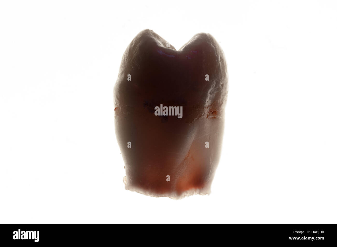 A clean extracted wisdom tooth, not fully developed Stock Photo - Alamy
