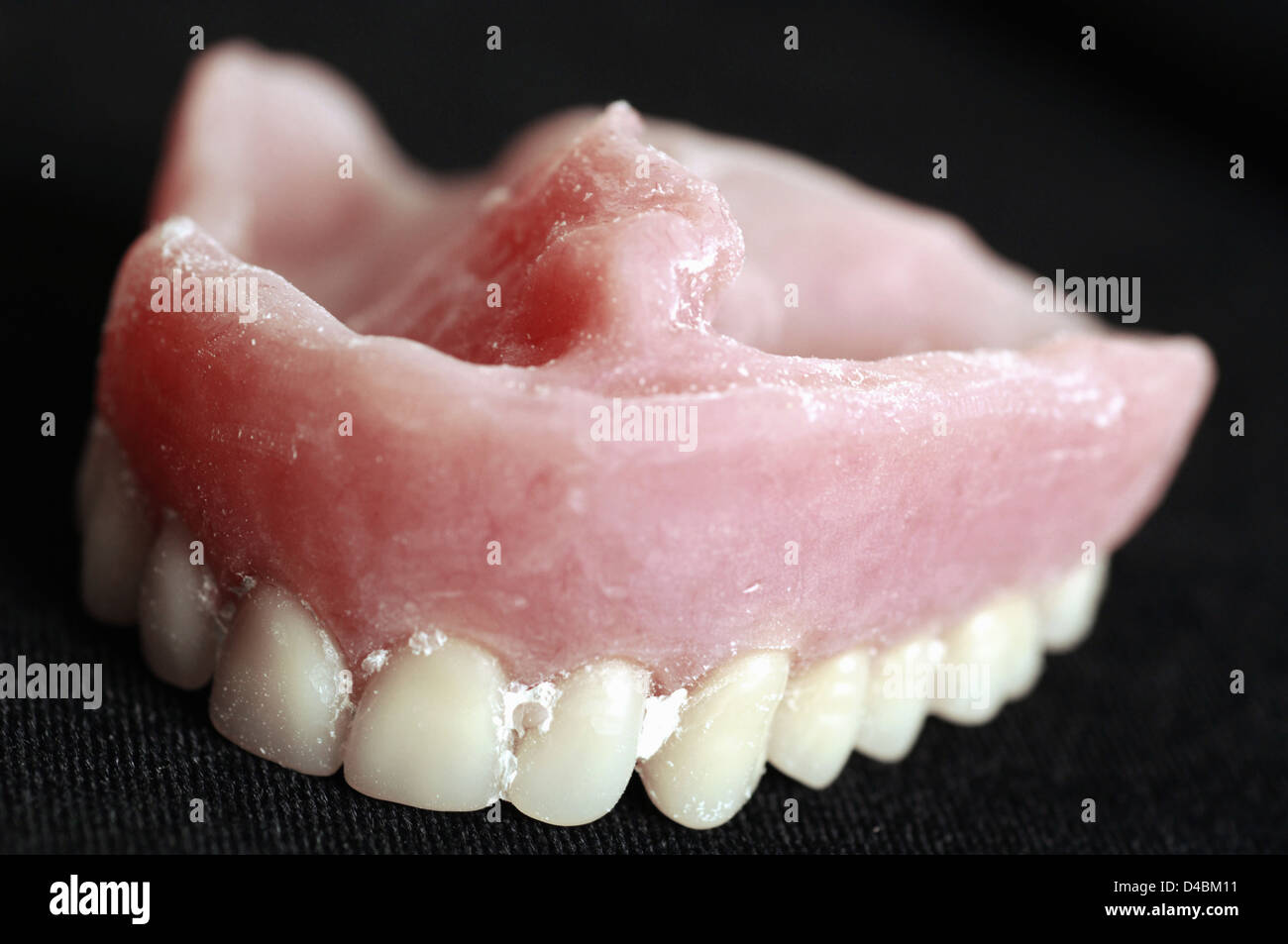 Denture for patient with cleph pallette Stock Photo - Alamy