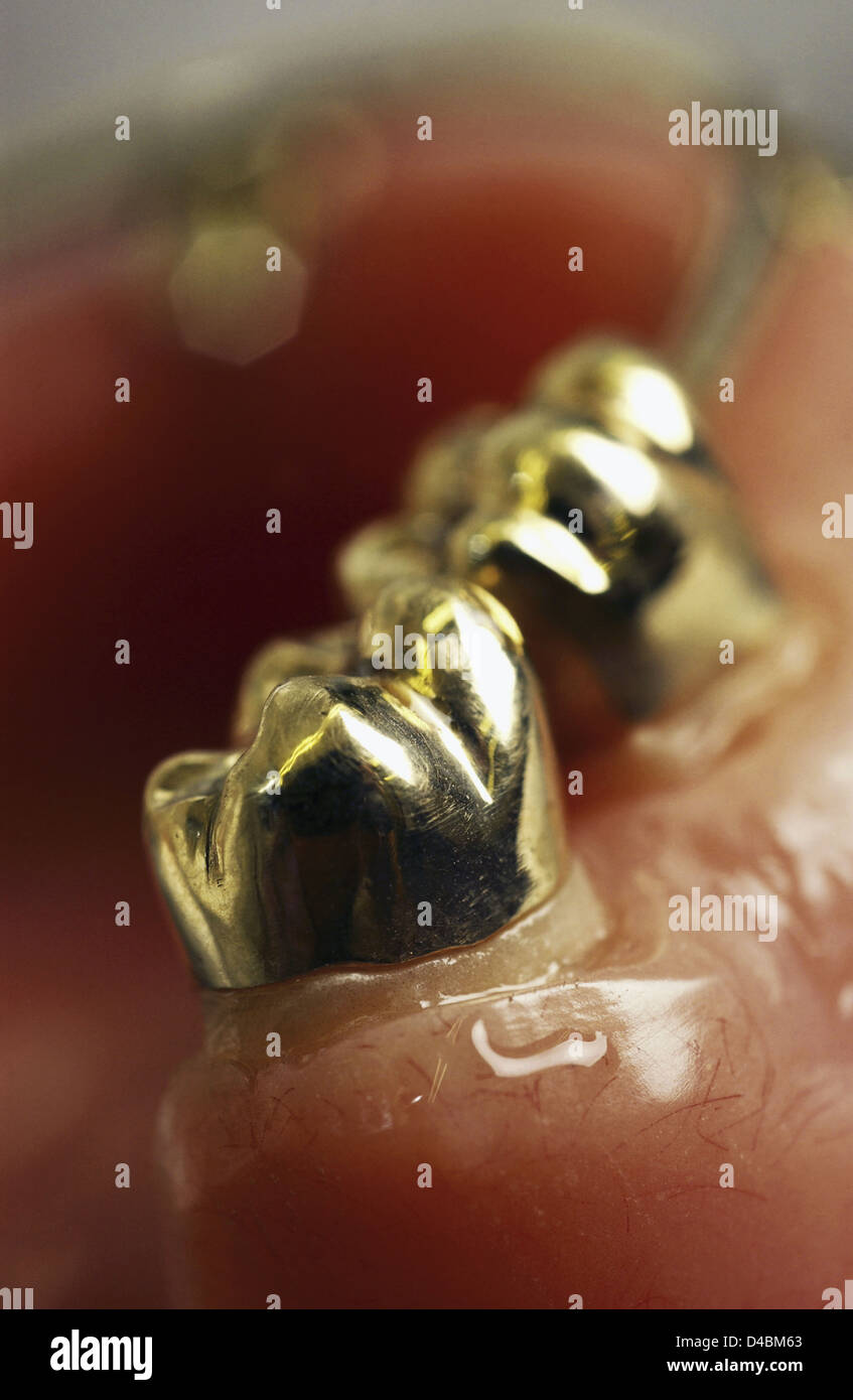 Completed set of gold crowns hi-res stock photography and images - Alamy