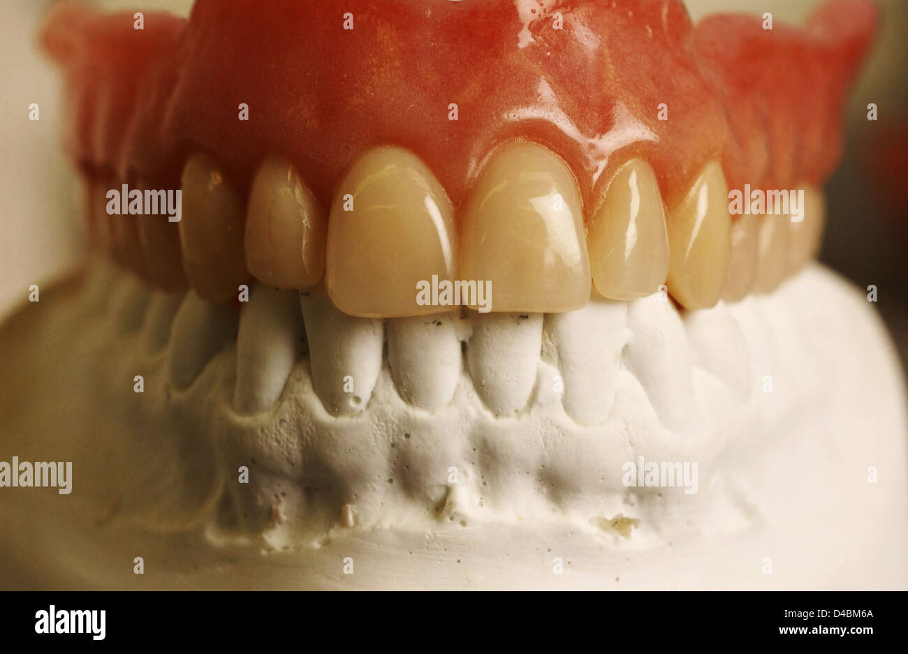 Completed set of dentures hi-res stock photography and images - Alamy