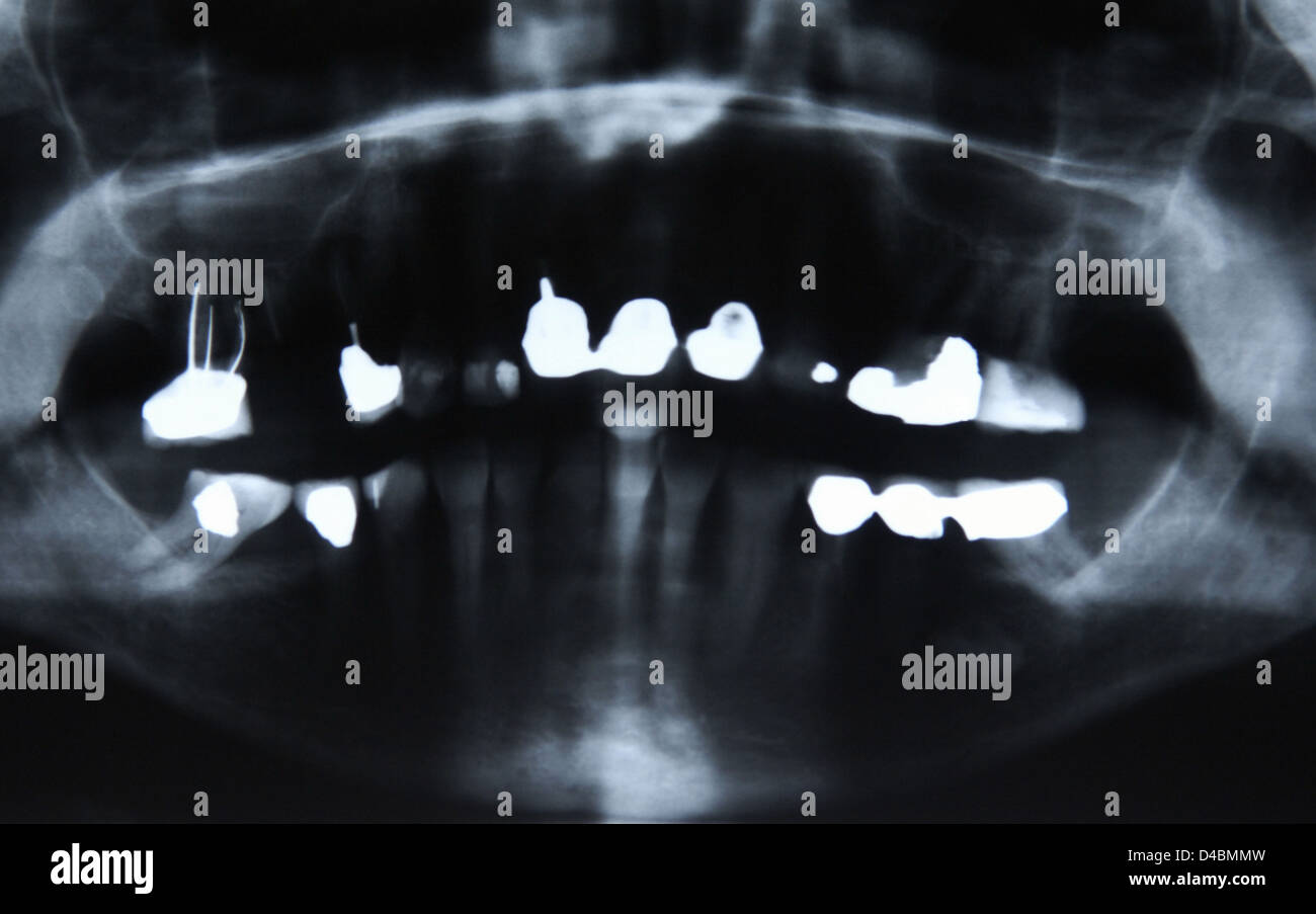 Maxillary studio hi-res stock photography and images - Alamy
