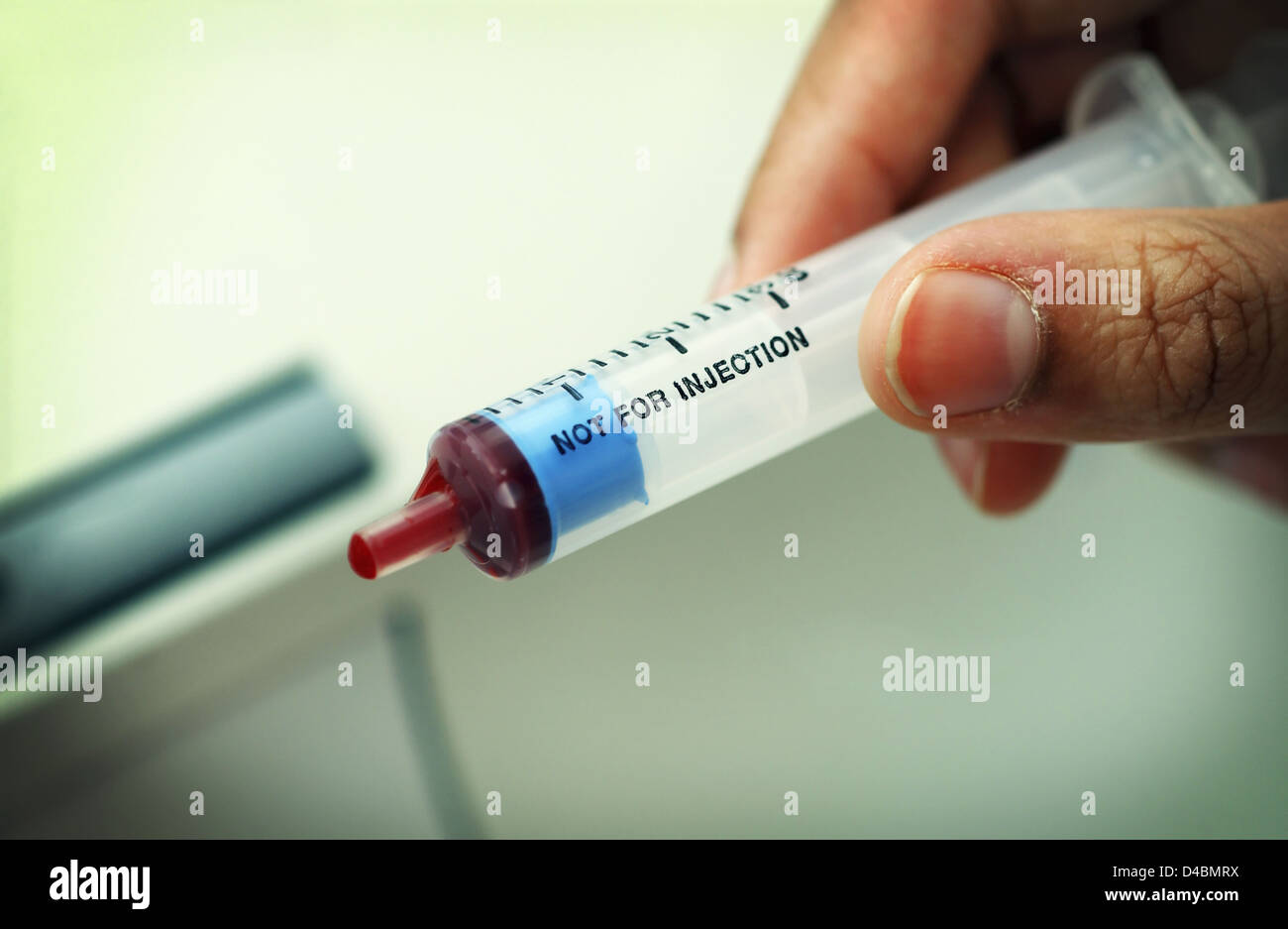 The blood sample is ready to be to analyze and washed in a specially ...