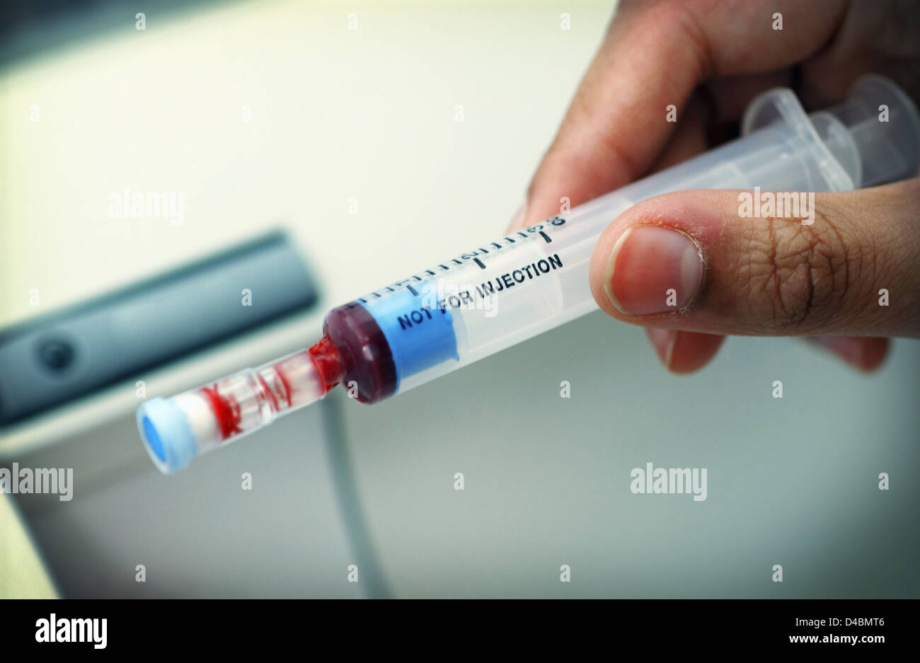 The blood sample is ready to be to analyze and washed in a specially ...