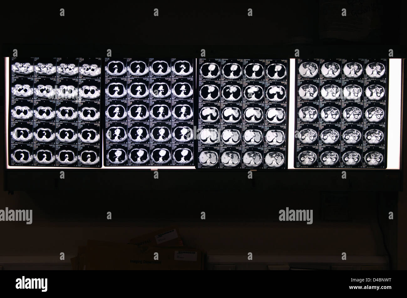Ct scans horizontal hi-res stock photography and images - Alamy