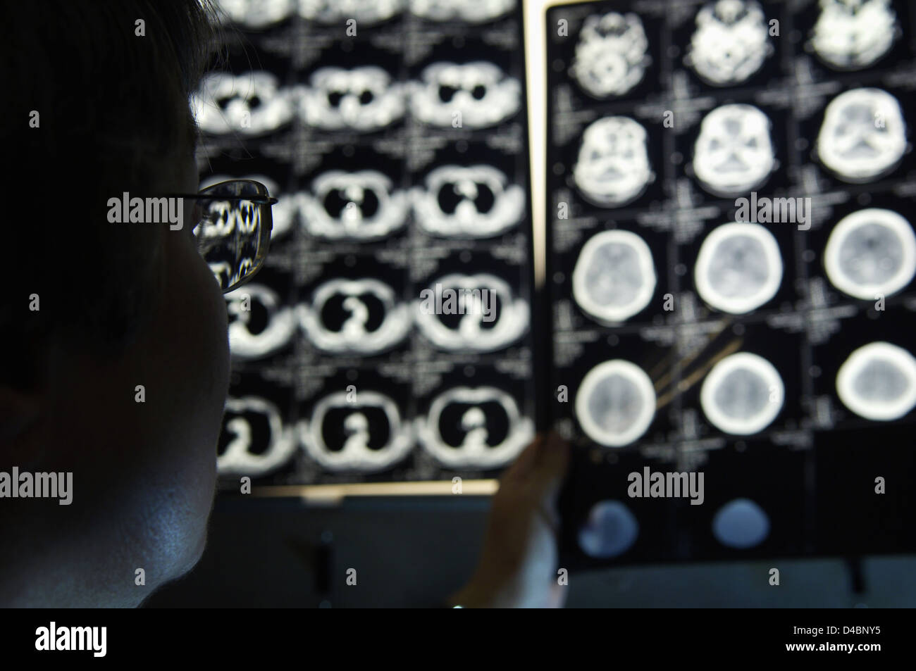 The ones he holding on right hand side picture cranial (head) scans ...