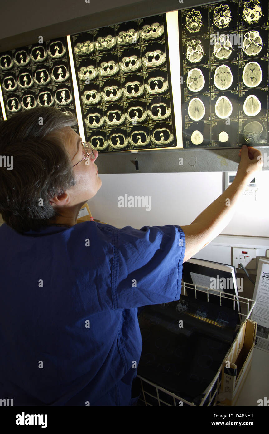 The scans developed into x-ray film examined using special light box ...