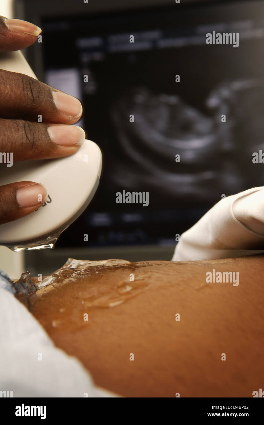 This image was taken during ultrasound process radiographer/sonographer ...
