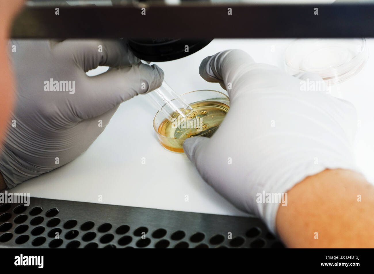 During surgery eggs collected female patient passed through lab. lab ...