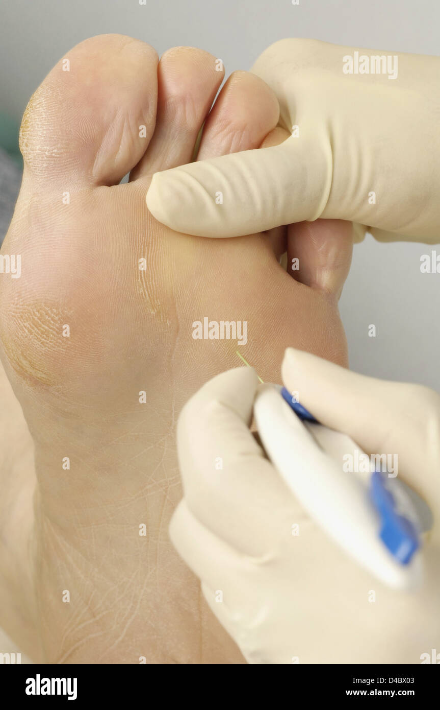 Skin sensitivity test hi-res stock photography and images - Alamy