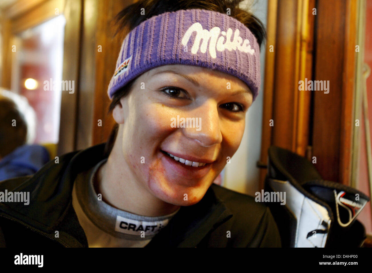 German Maria Riesch shows her injured chin while waiting for the second ...