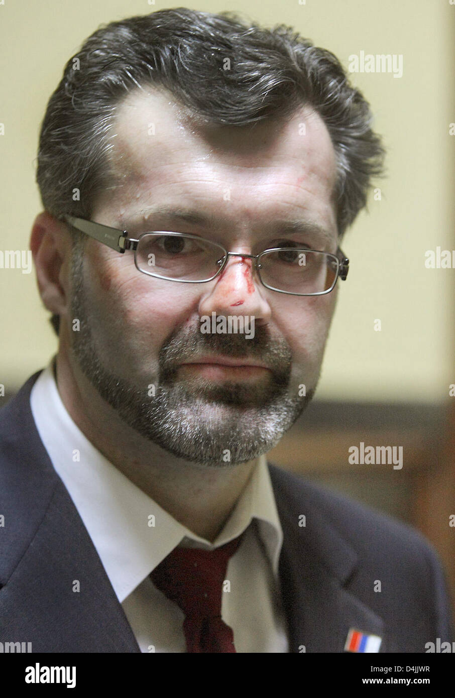 Igor Becic, member of the Serbian parliament, pictured with a bloodied ...