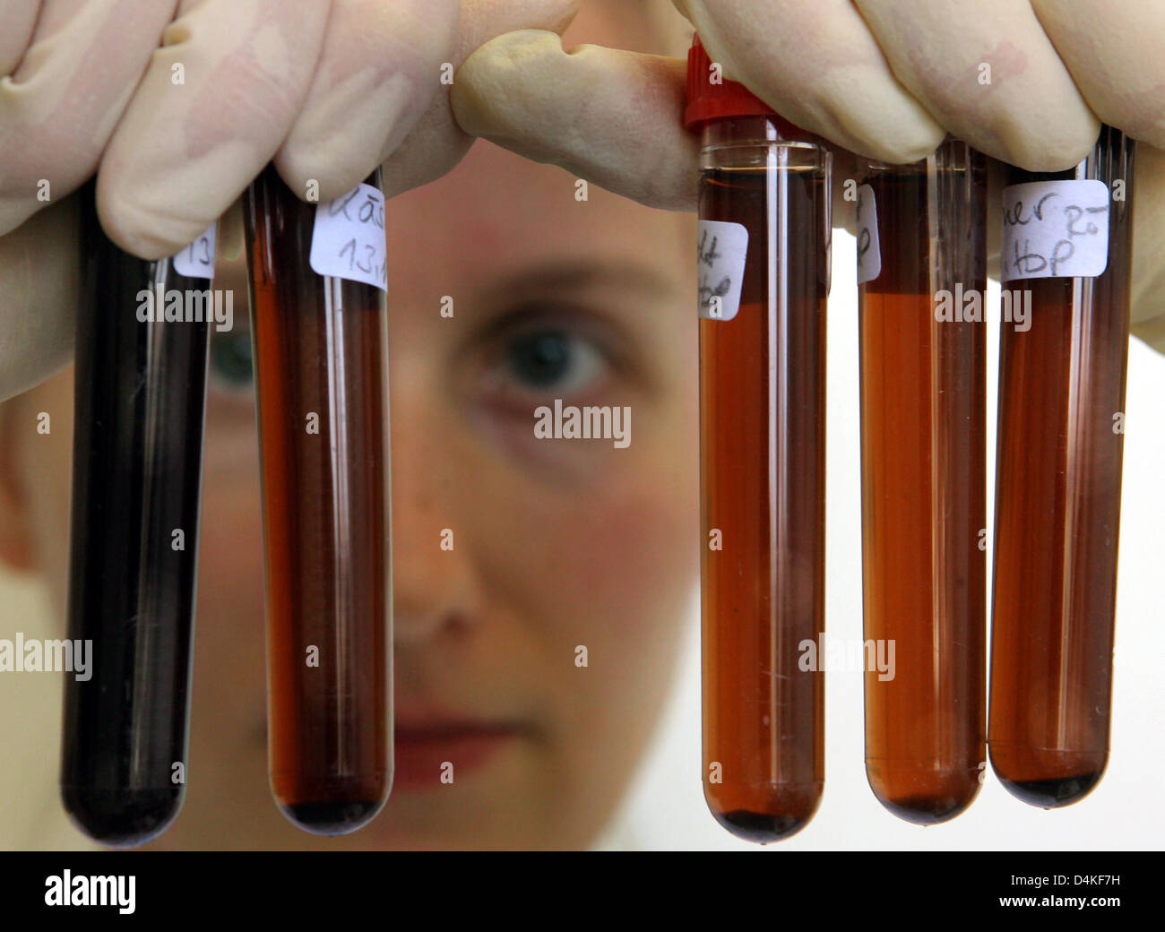 (file) - The file picture dated 14 November 2008 shows medical ...