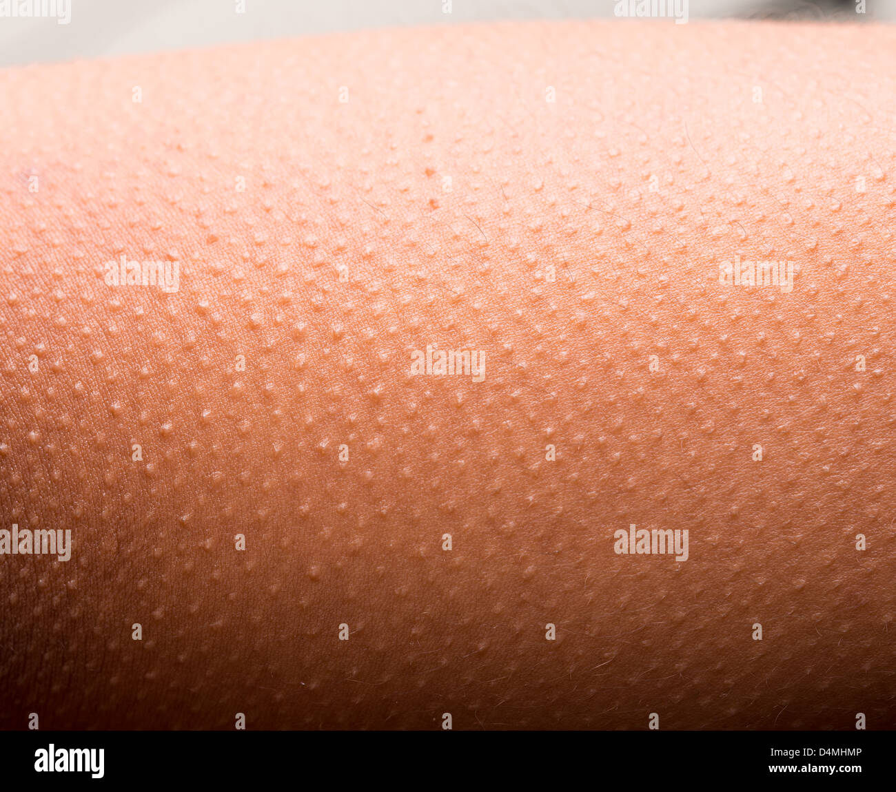 Skin treatment cold hi-res stock photography and images - Alamy