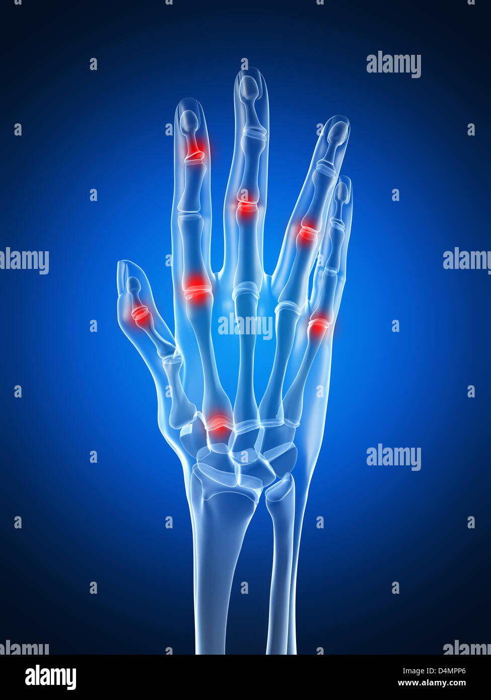 X ray hand hi-res stock photography and images - Alamy