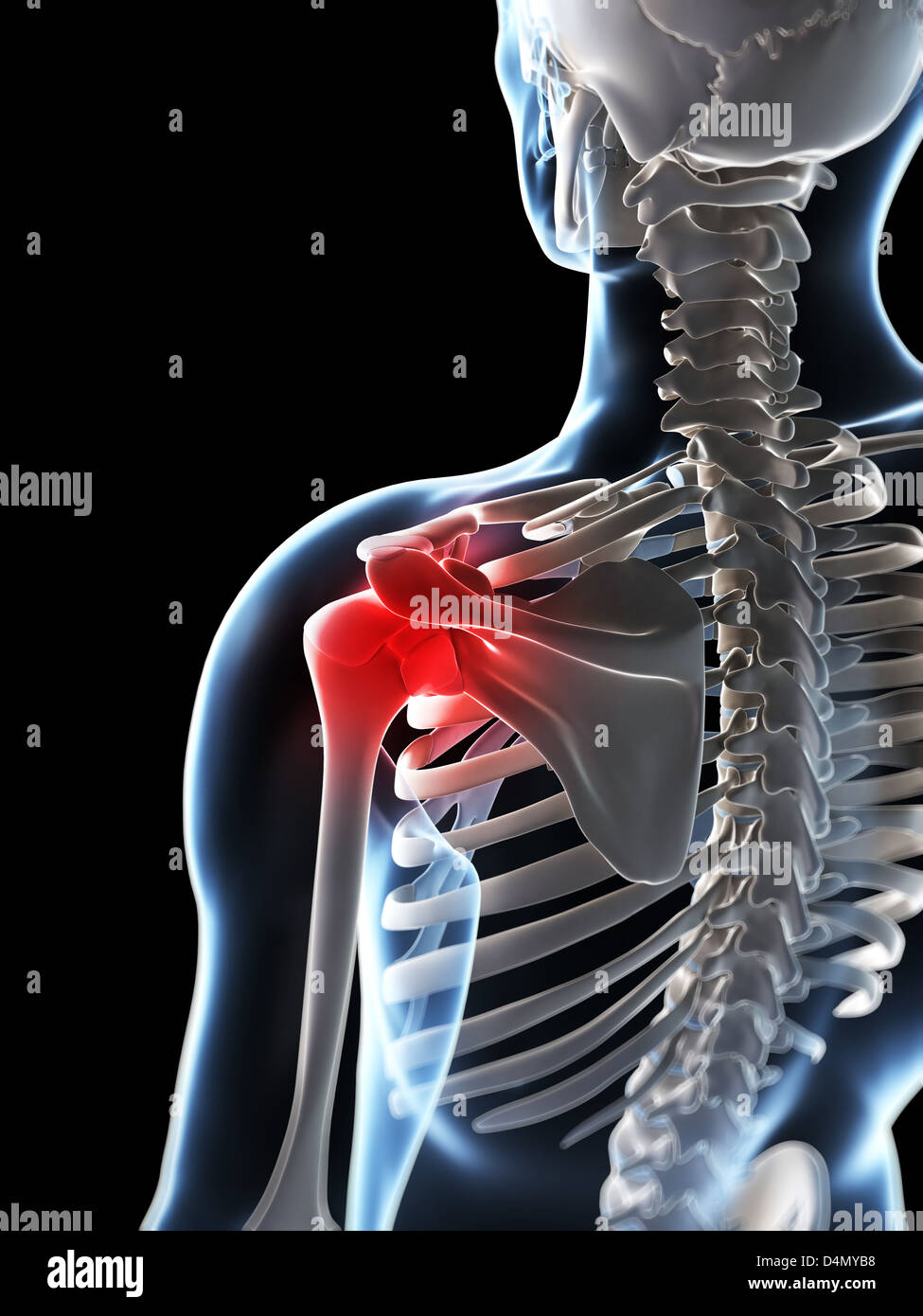 Shoulder joint x ray hi-res stock photography and images - Alamy